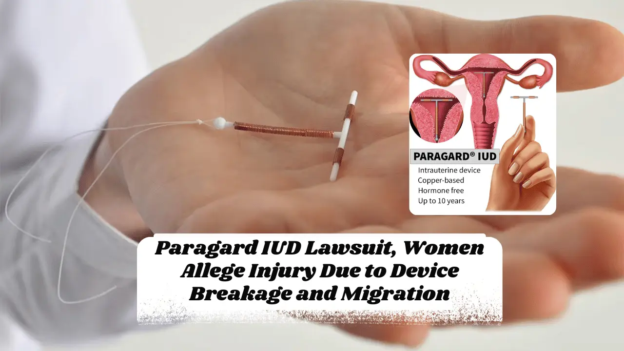 Paragard IUD Lawsuit, Women Allege Injury Due To Device Breakage And Migration